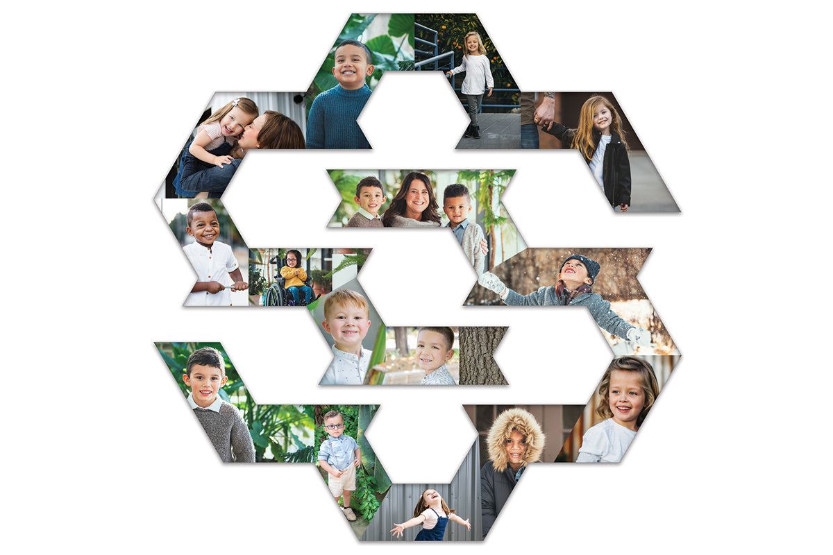 White Crowns for Children – Golden Kids Dental & Orthodontics